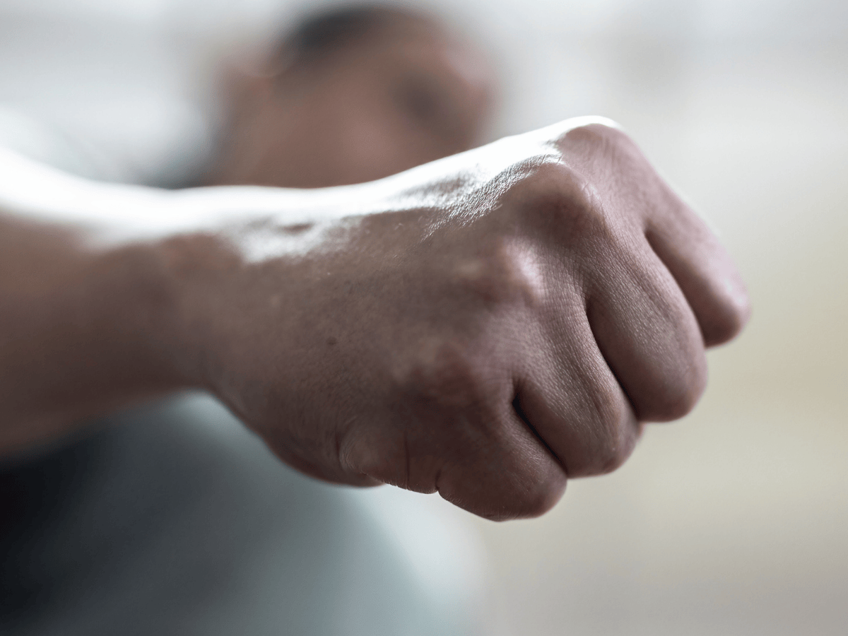 Your Legal Guide to Assault Charges in CO